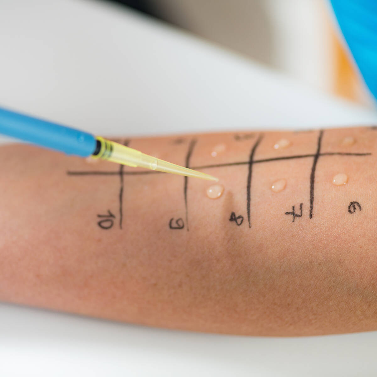 Allergy Testing Basics: Purpose, Types and Meaning