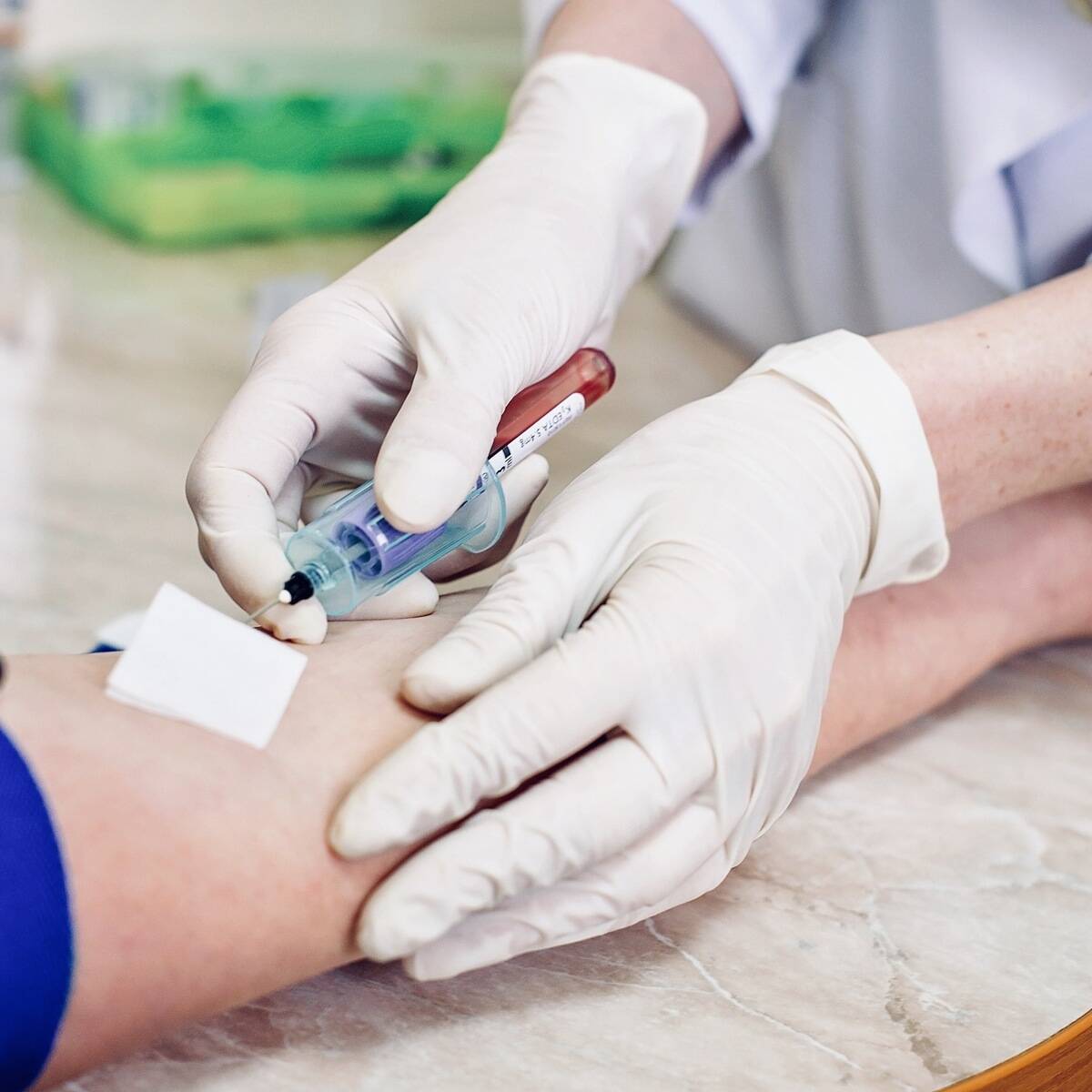 Liver Function Test: A Complete Overview