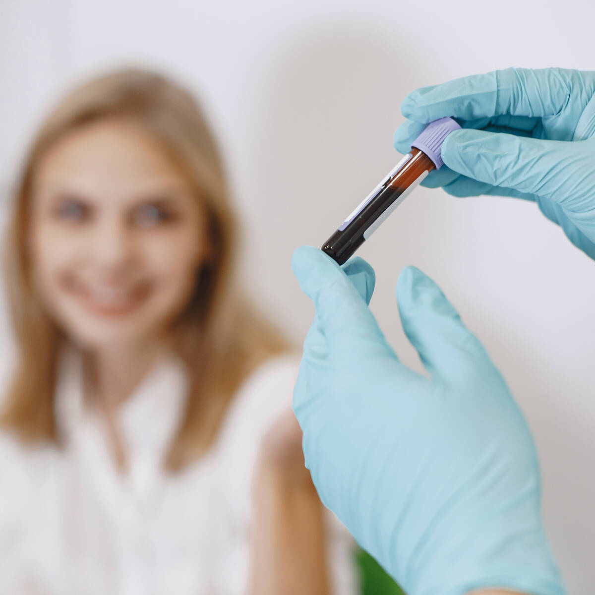 Total Iron-Binding Capacity Test (TIBC): How to prepare & understand ...